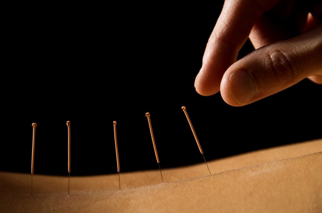 Acupuncture – Project Yourself